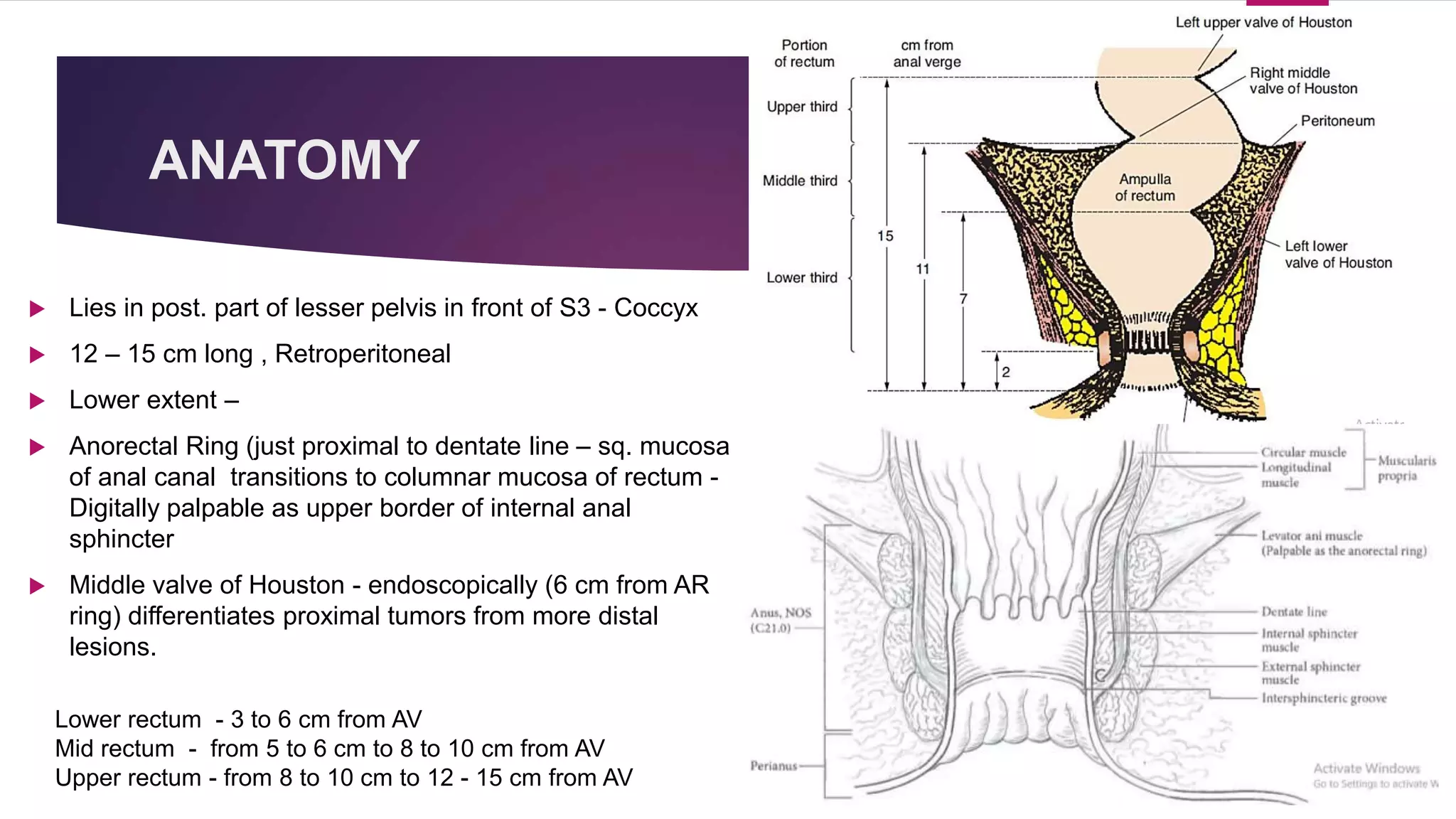Locally Advanced Rectal Cancer Pptx