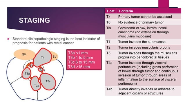 Locally Advanced Rectal Cancer | PPTX