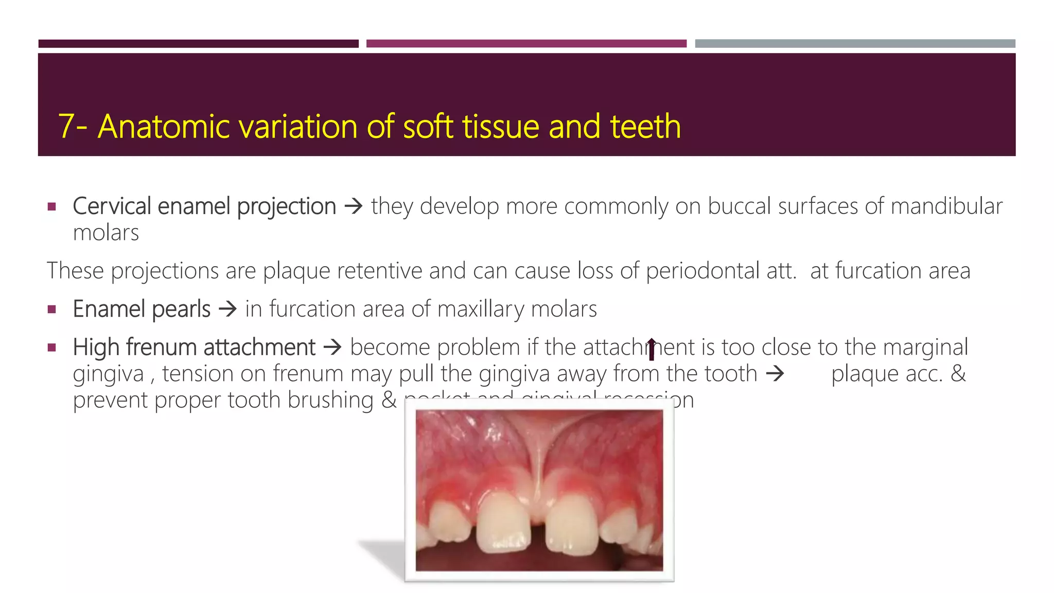 Local predisposing factor of periodontal disease | PPTX