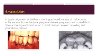Local predisposing factor of periodontal disease | PPTX