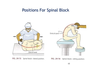 Local & regional anaesthesia | PPT