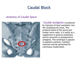 Local & regional anaesthesia | PPT