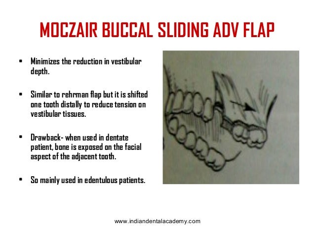 Local & regional flaps /certified fixed orthodontic courses by Indian…