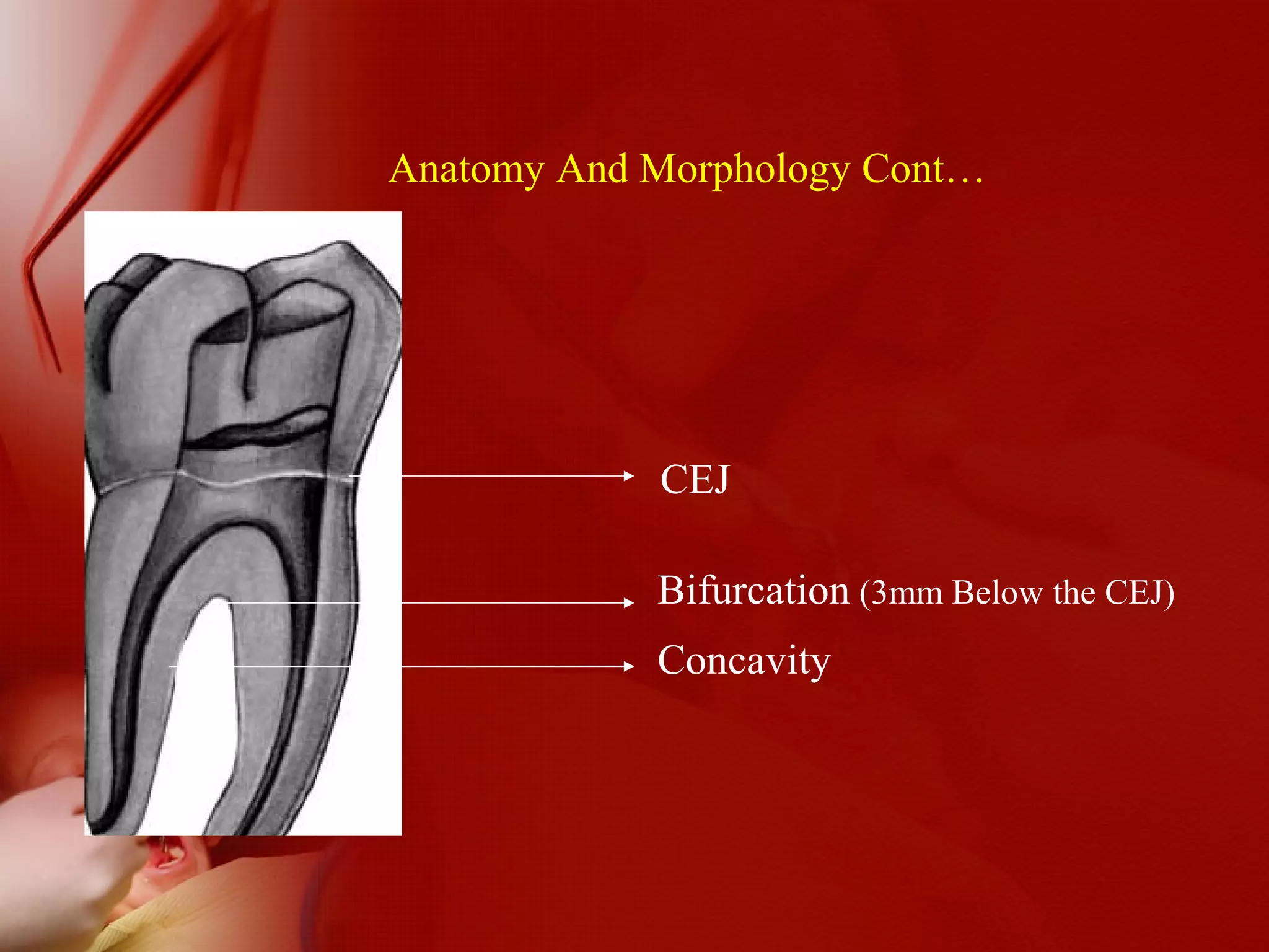 Locating root canal orifice in molar RCT | PPT