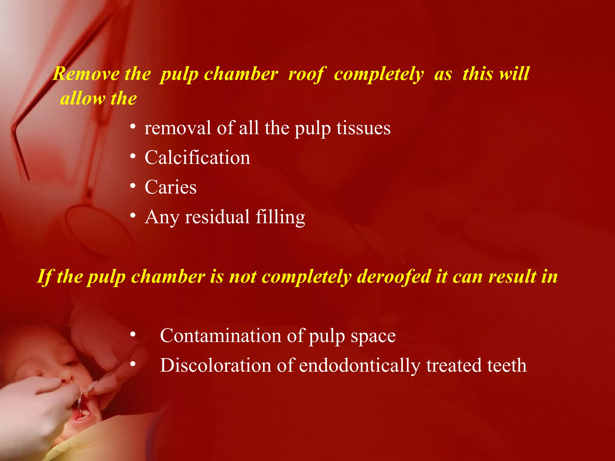 Locating root canal orifice in molar RCT | PPT