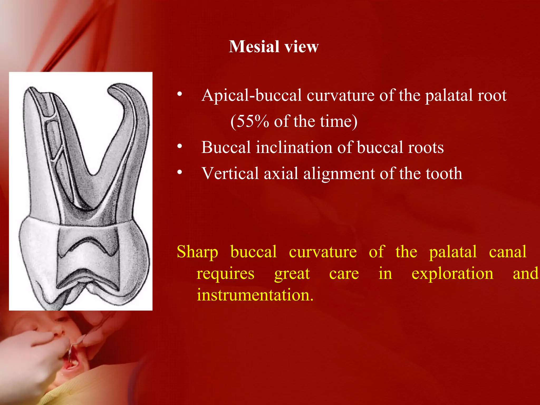Locating root canal orifice in molar RCT | PPT