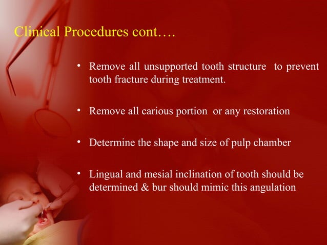 Locating root canal orifice in molar RCT | PPT