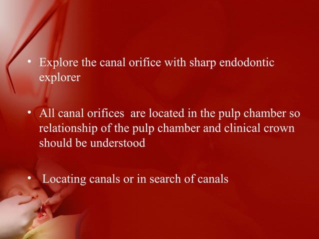 Locating root canal orifice in molar RCT | PPT