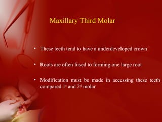 Locating root canal orifice in molar RCT | PPT