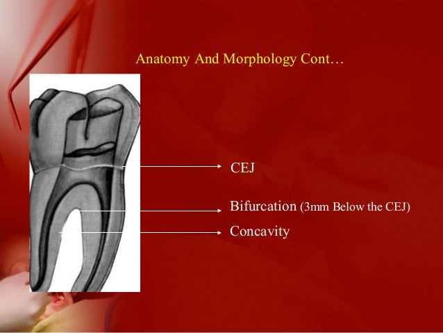 Locating Root Canal Orifice In Molar Rct