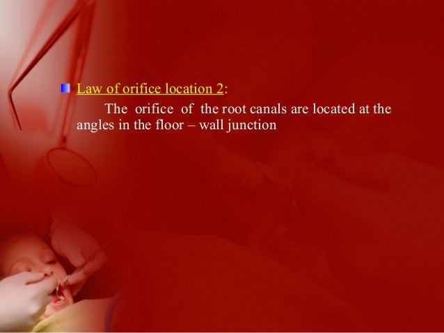 Locating Root Canal Orifice In Molar Rct
