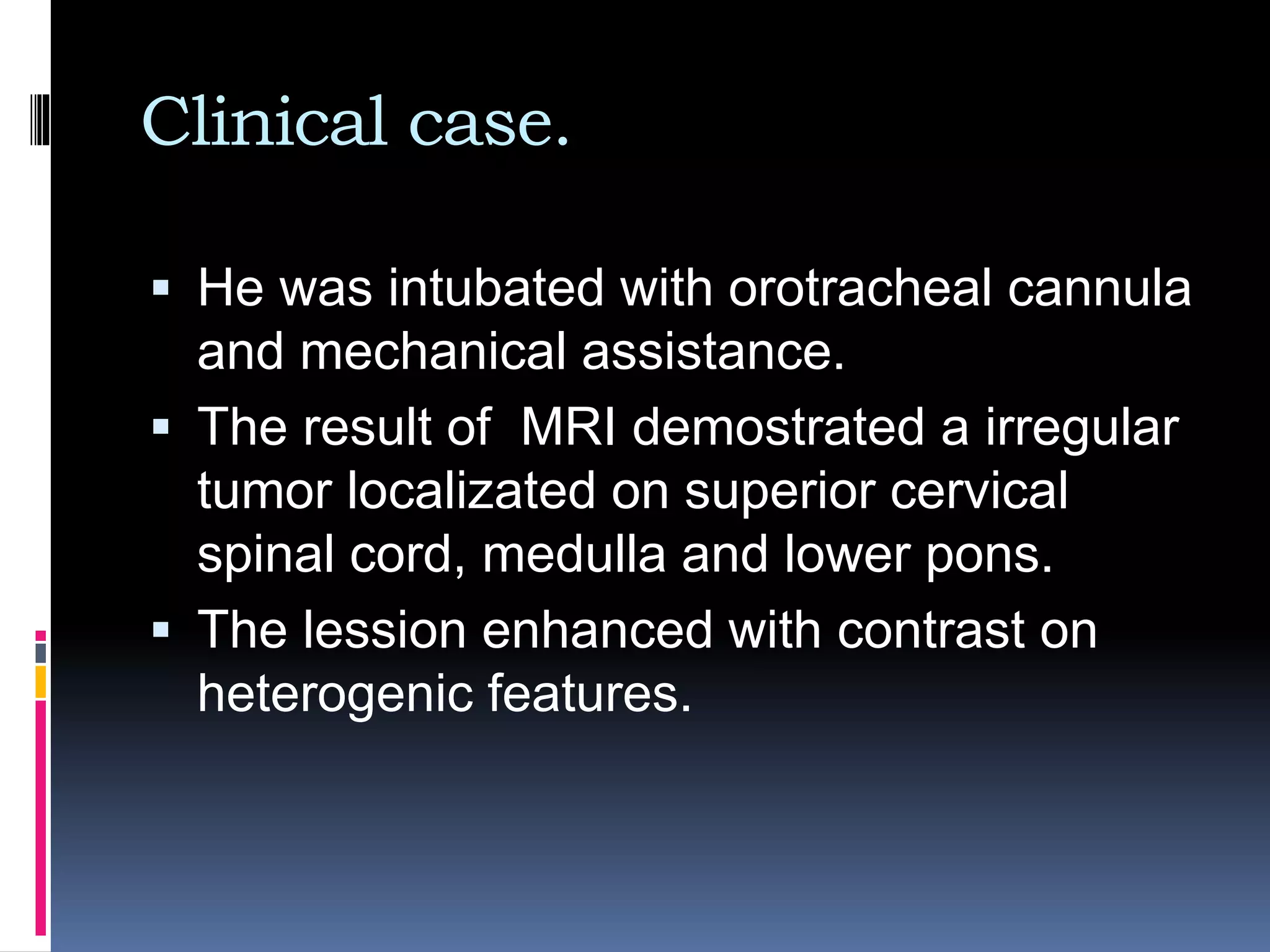 Locked in syndrome secondary a multiform glioblastoma in brain stem ...
