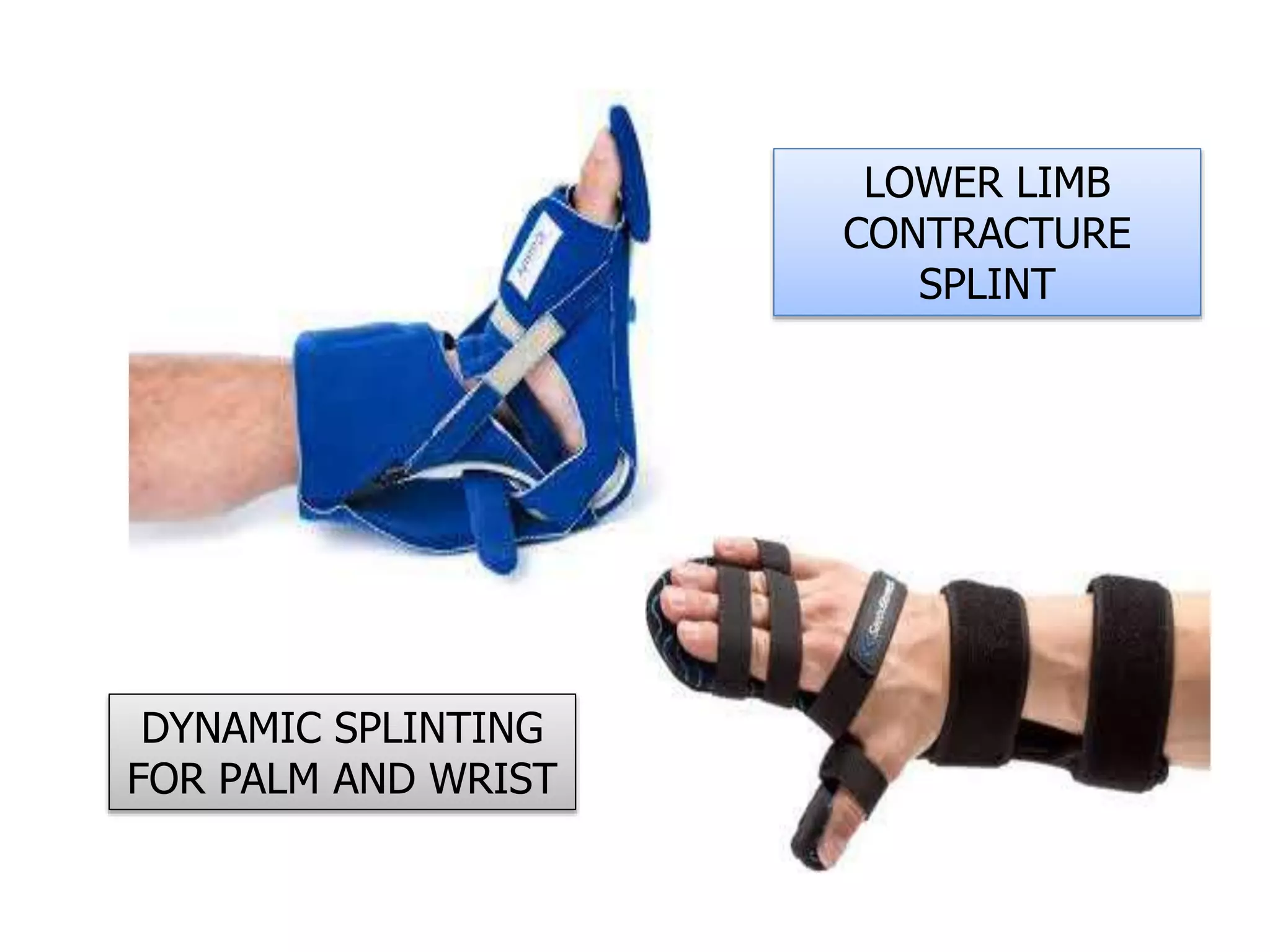 Locomotor disabilities | PPT