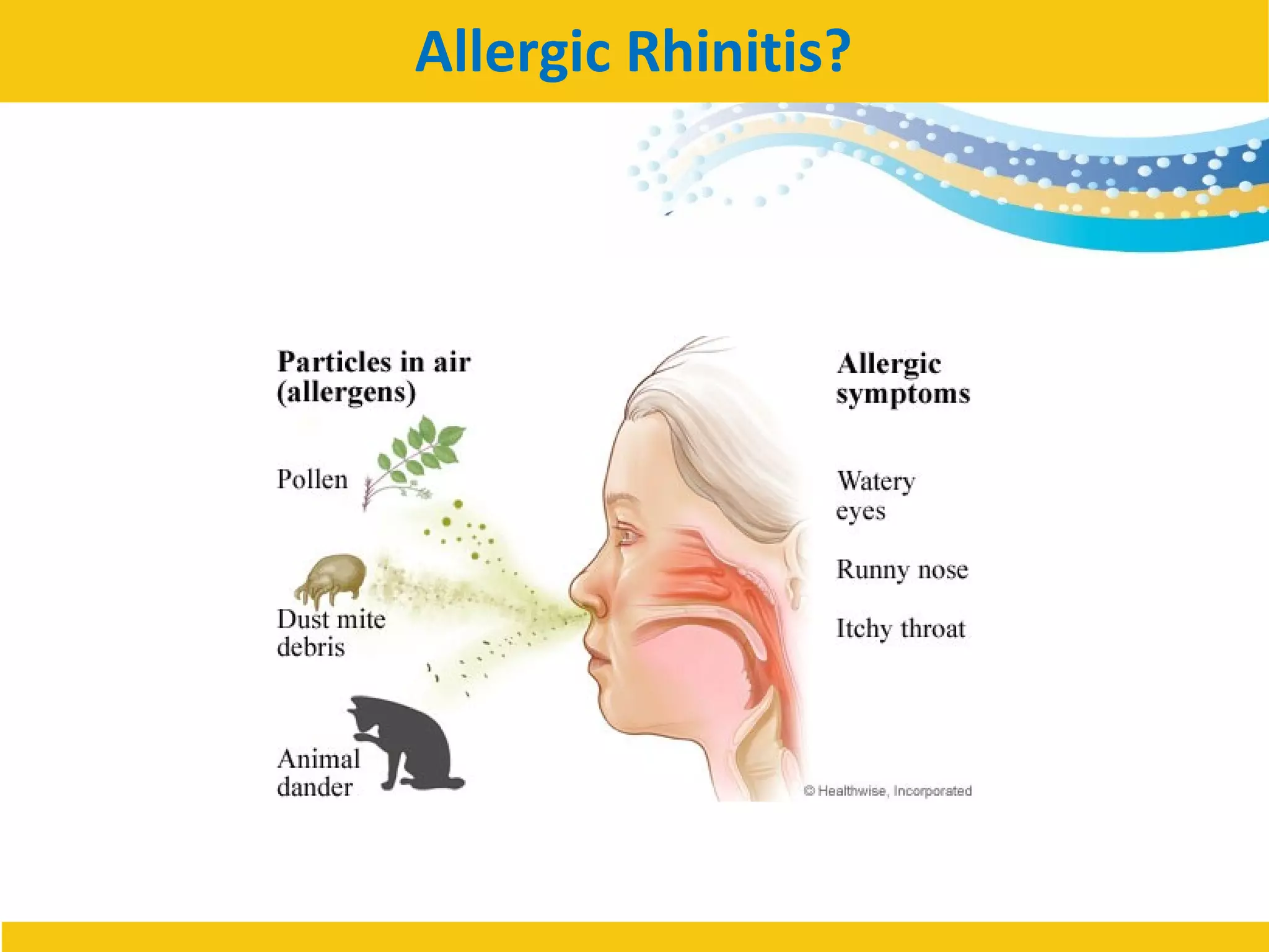 Loctril (Montelukast) | PPT