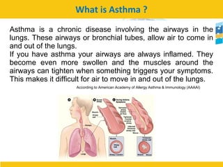 Loctril (Montelukast) | PPT