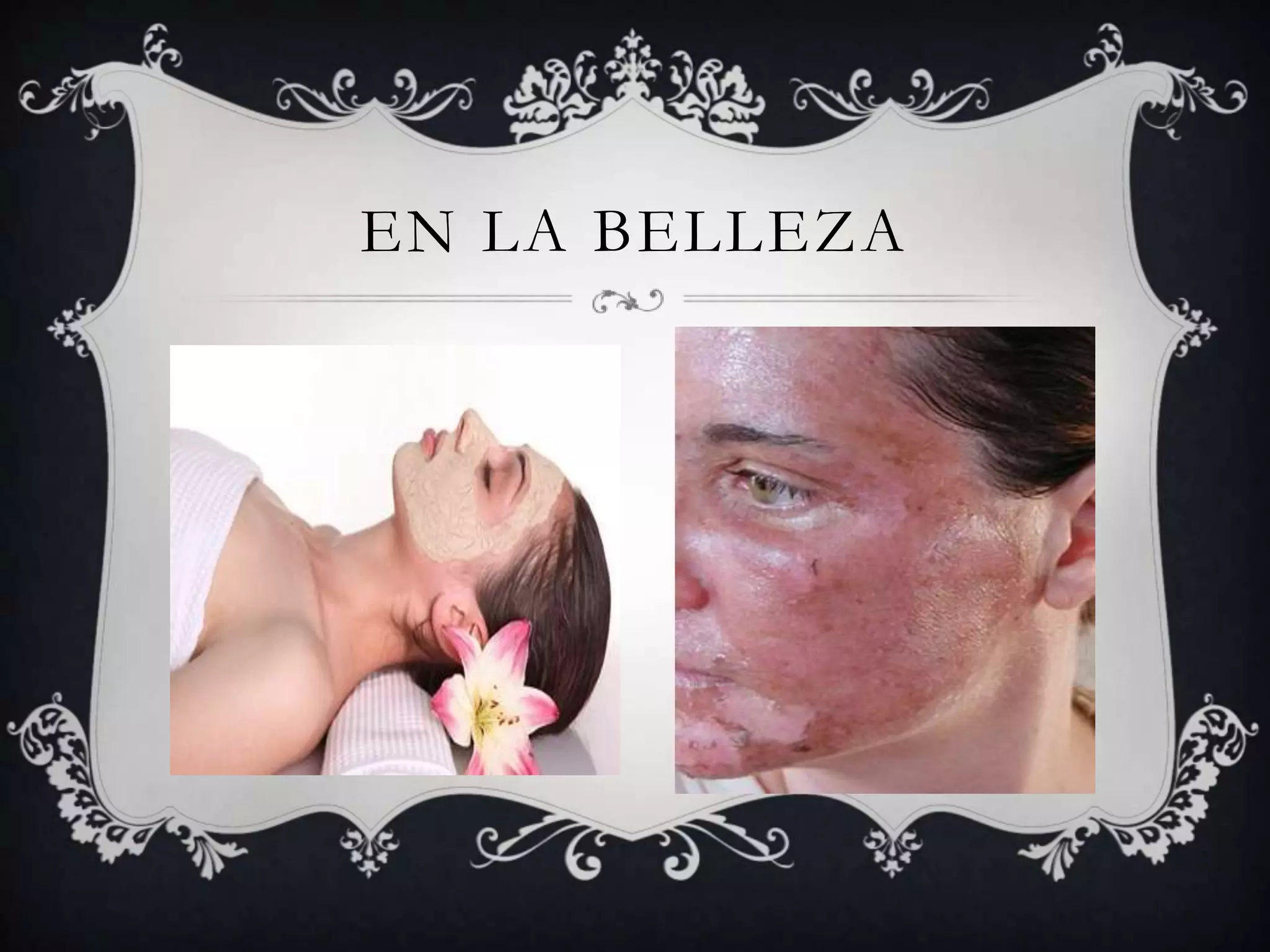 Lo estetico y lo antiestetico | PPTX