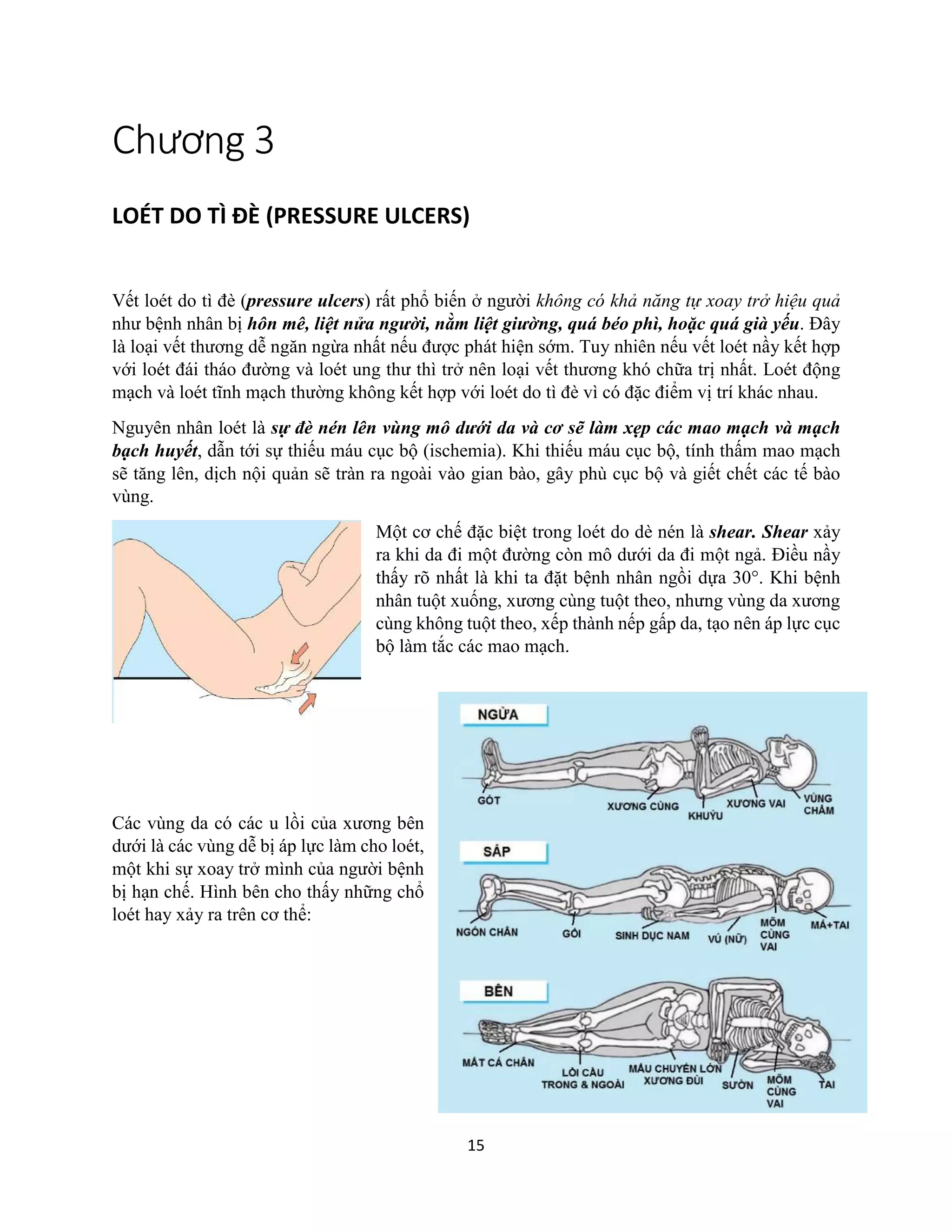 Loét tì đè | PDF