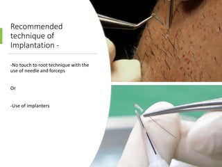 Logic of implantation | PPT