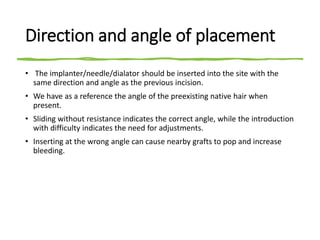 Logic of implantation | PPT