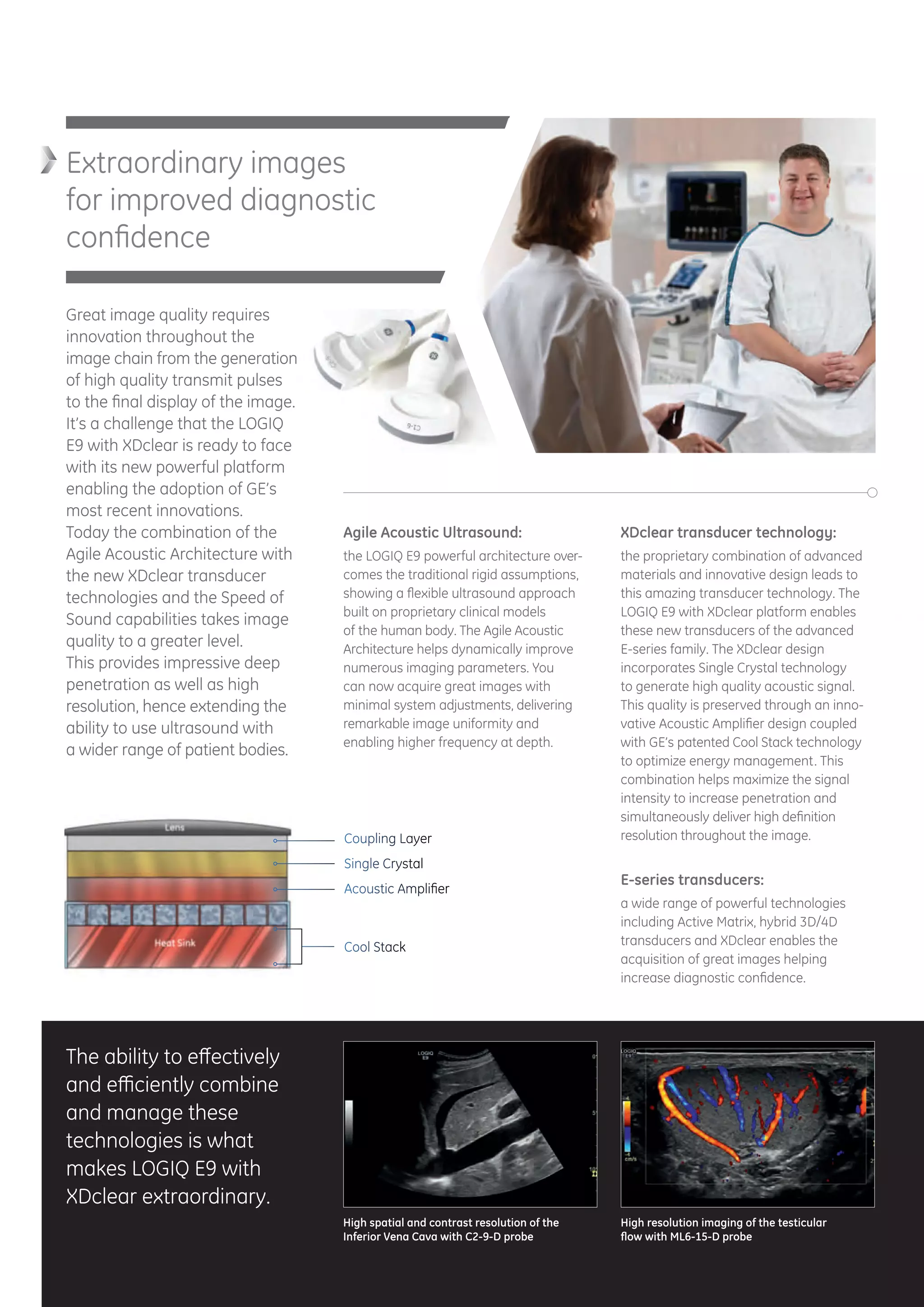 Logiq e9 xd clear brochure | PDF