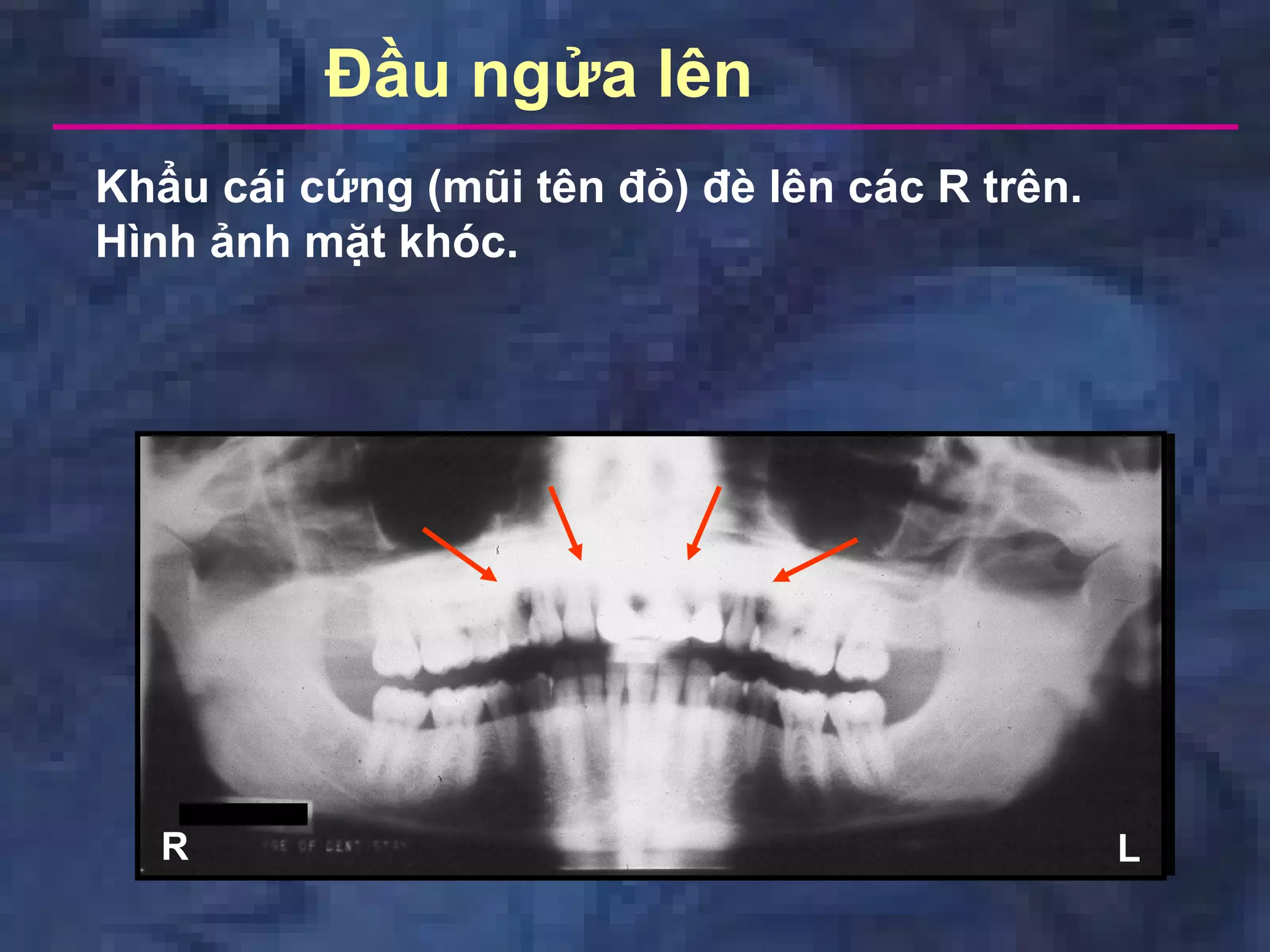 Loi ky thuat phim toan canh panoramic-errors | PPT