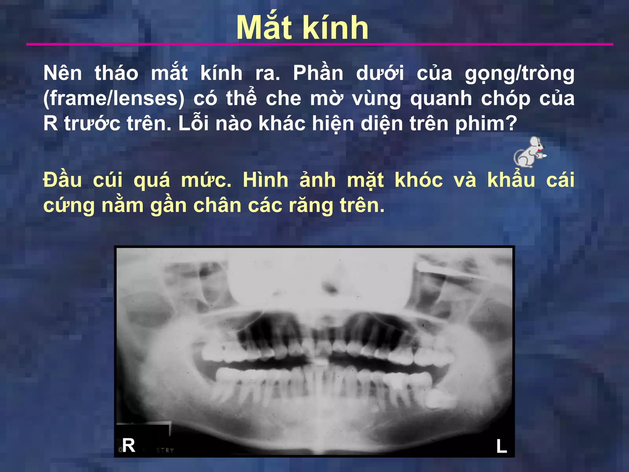 Loi ky thuat phim toan canh panoramic-errors | PPT