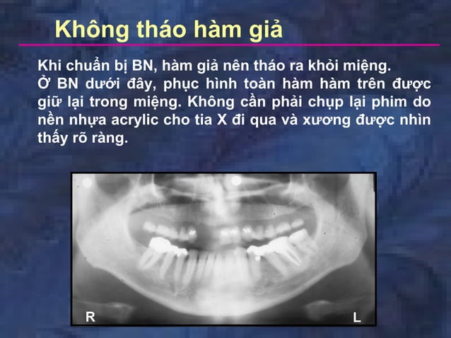 Loi ky thuat phim toan canh panoramic-errors | PPT