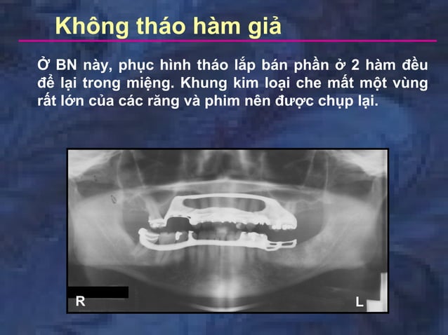 Loi ky thuat phim toan canh panoramic-errors | PPT