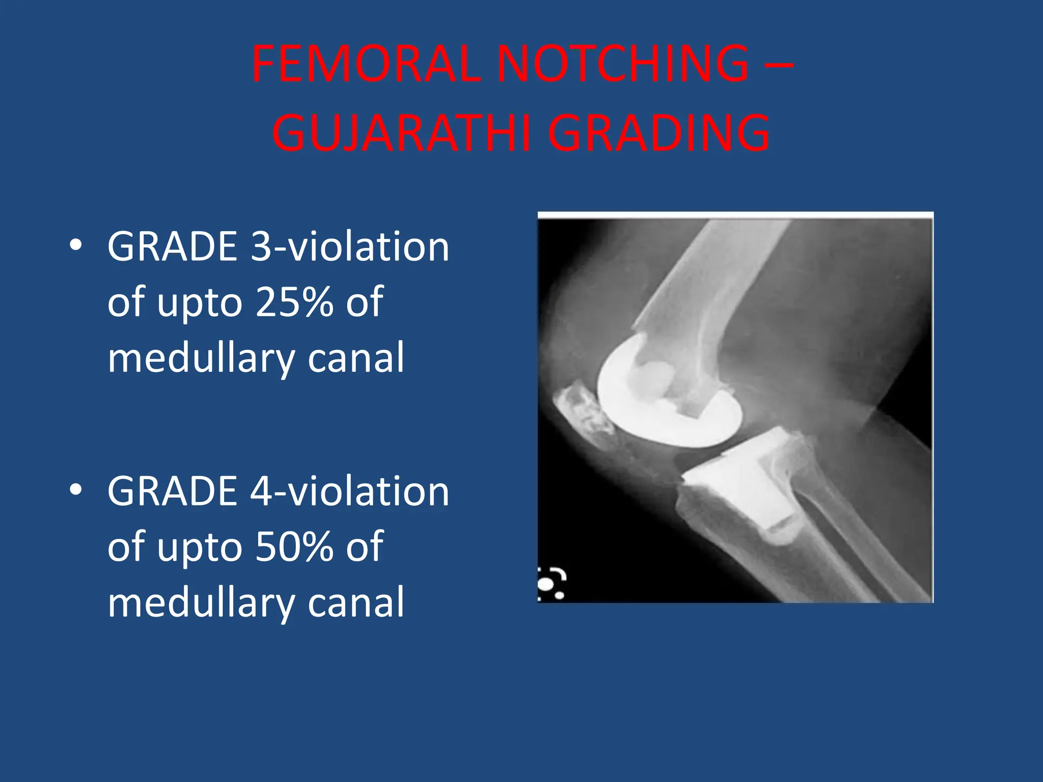 How to Interpret Postoperative X- ray after Total knee arthroplasty.pptx