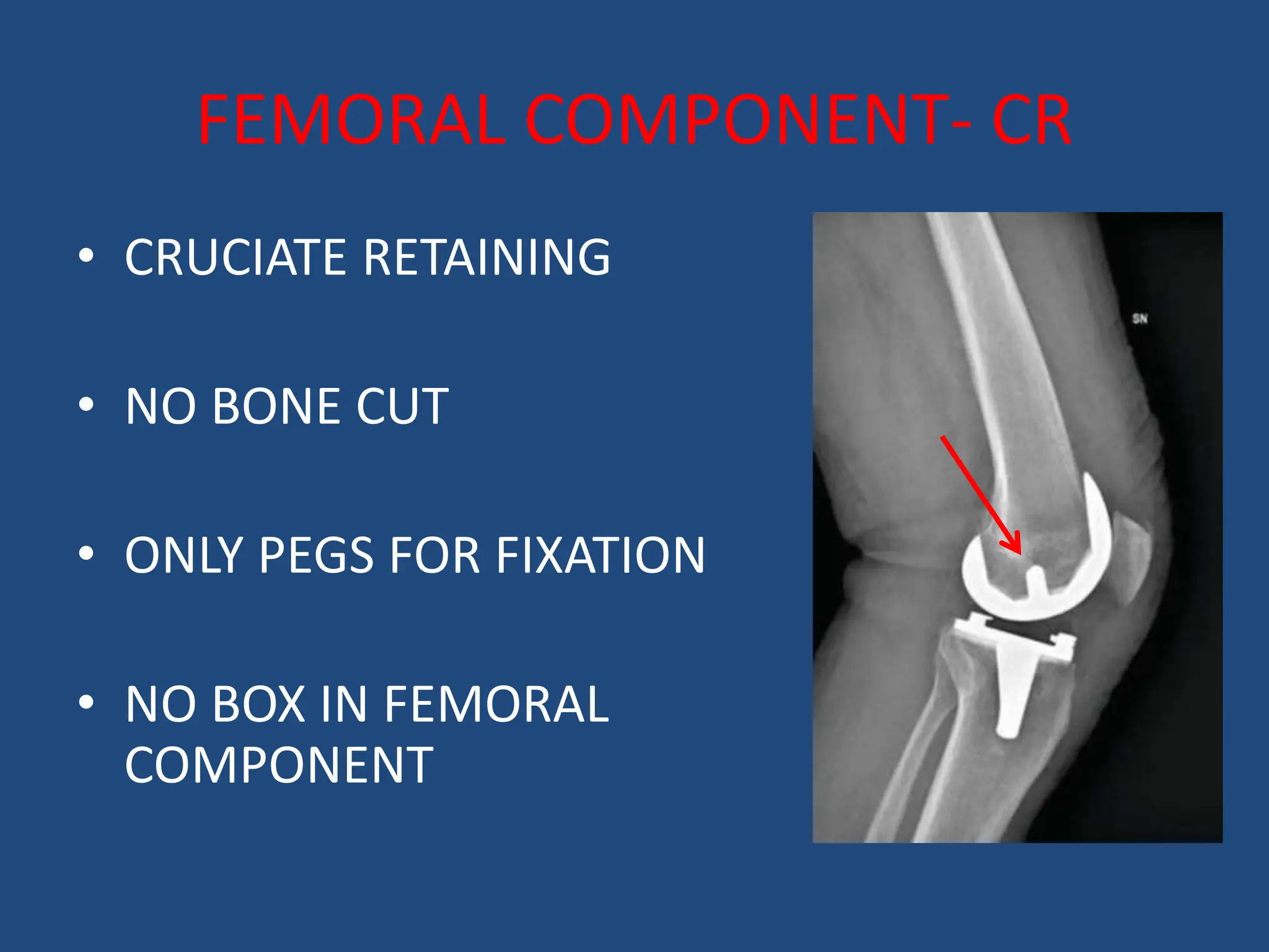 How to Interpret Postoperative X- ray after Total knee arthroplasty.pptx