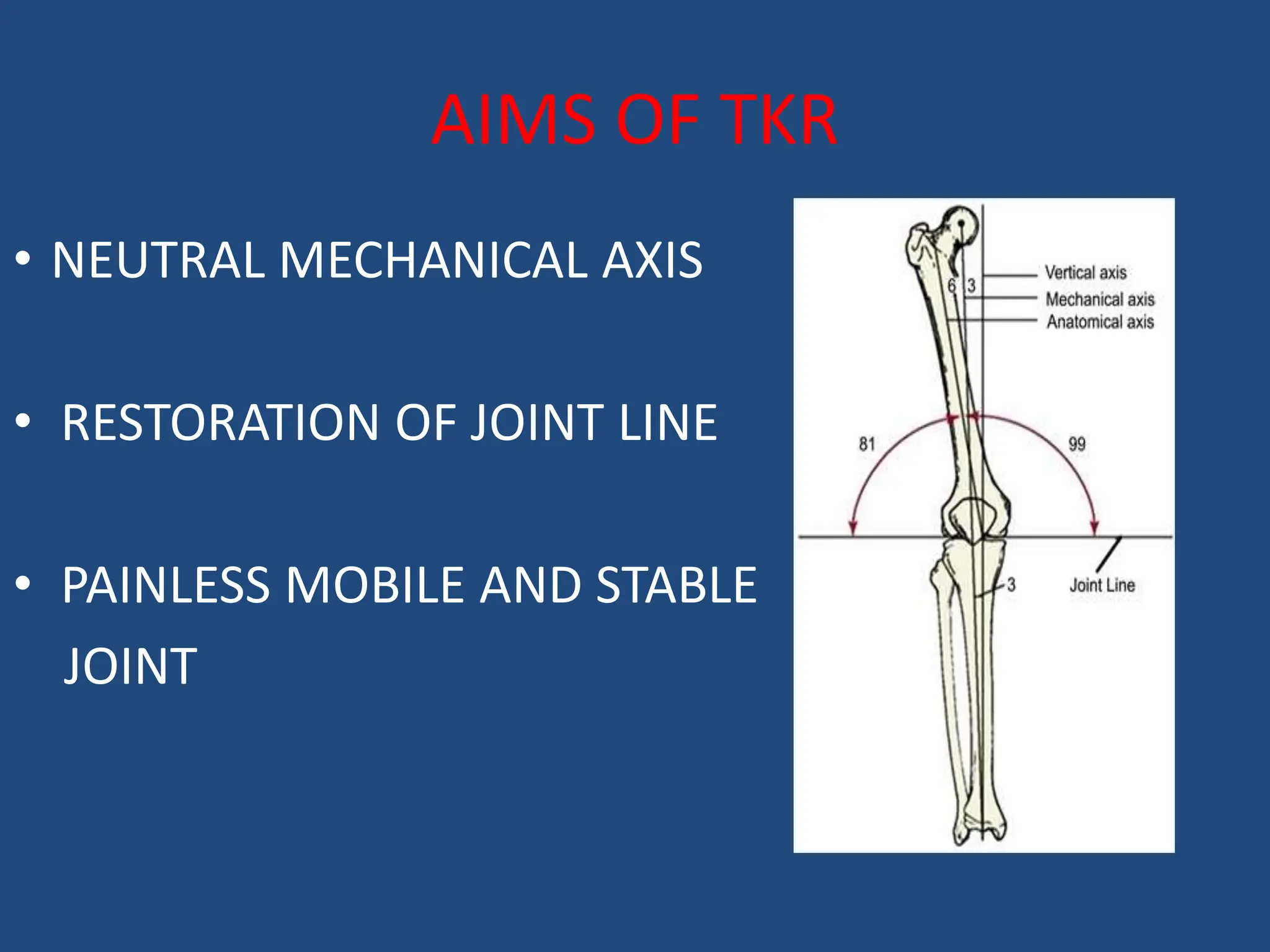 How to Interpret Postoperative X- ray after Total knee arthroplasty.pptx