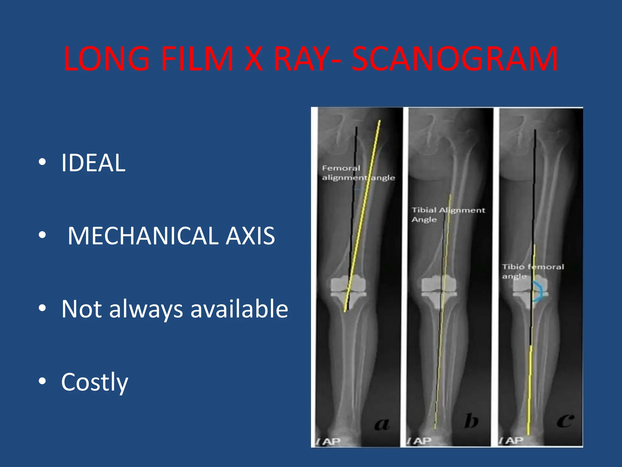 How to Interpret Postoperative X- ray after Total knee arthroplasty.pptx