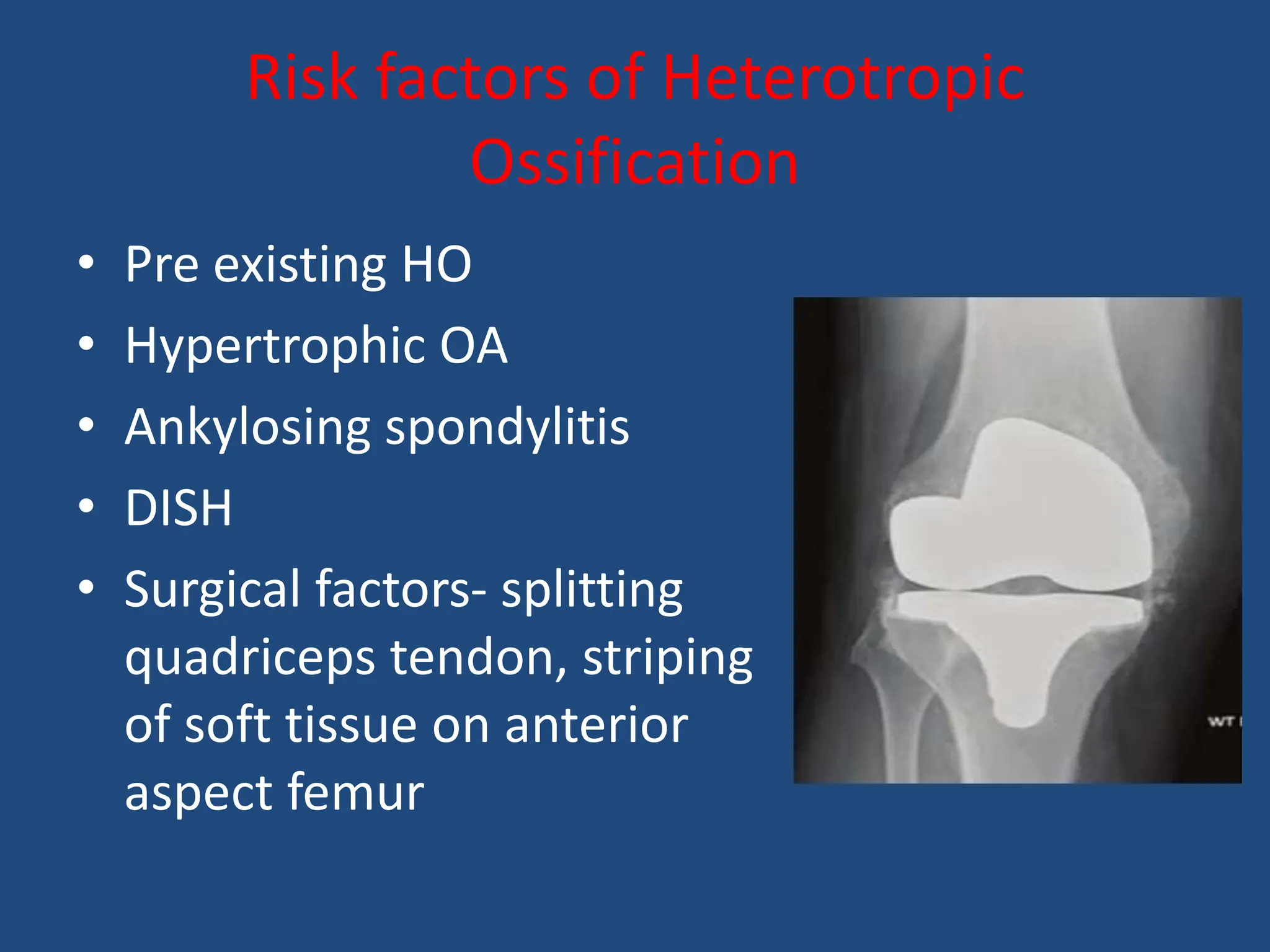 How to Interpret Postoperative X- ray after Total knee arthroplasty.pptx