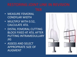How to Interpret Postoperative X- ray after Total knee arthroplasty.pptx