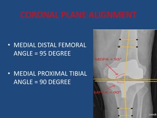 How to Interpret Postoperative X- ray after Total knee arthroplasty.pptx