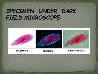 Dark field microscope | PPT