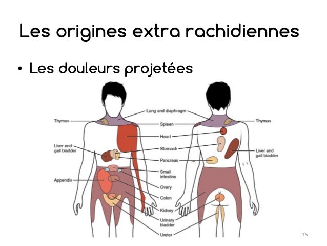 Lombalgies, Rachialgies: Pièges diagnostiques