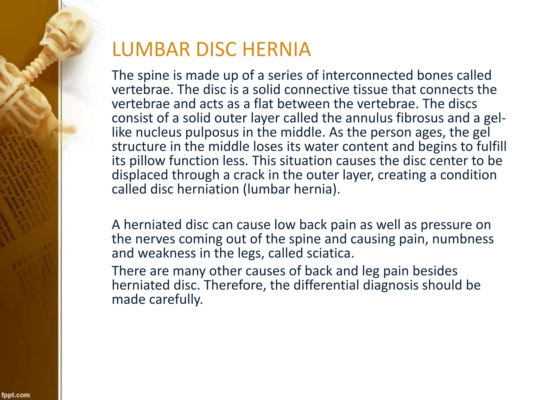 Lomber disk hernia.pptx