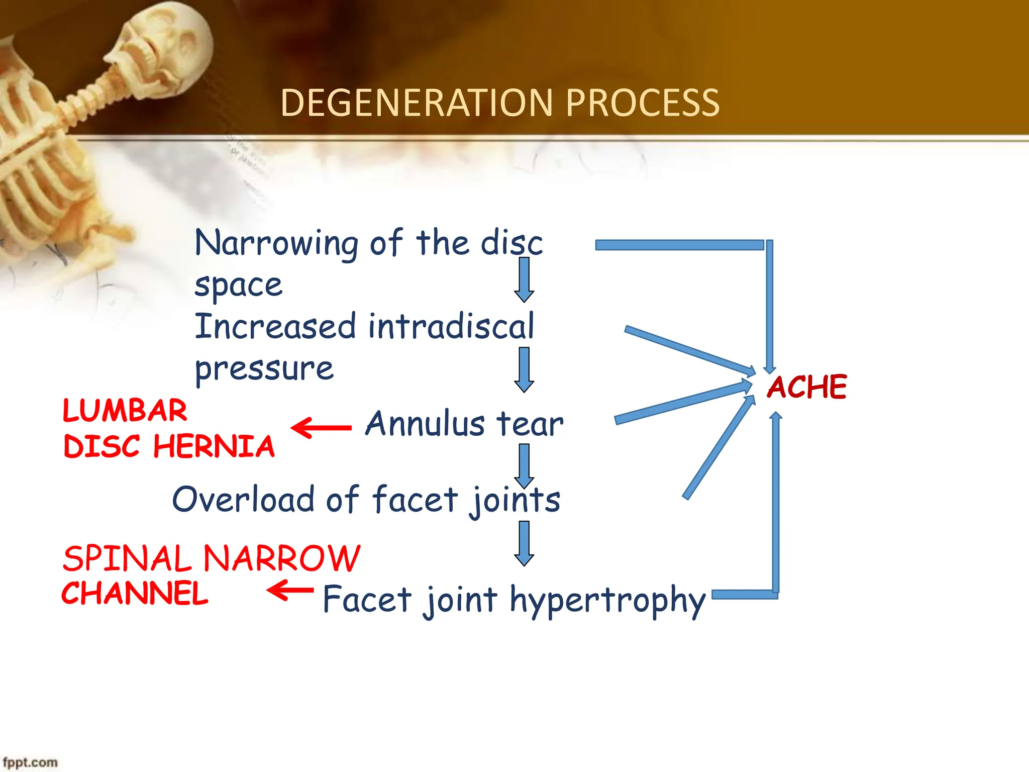 Lomber disk hernia.pptx