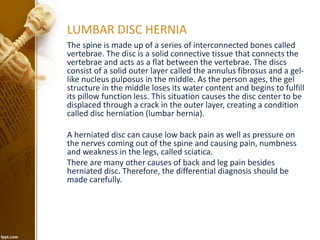 Lomber disk hernia.pptx | Death, Injury, or Military Conflict ...