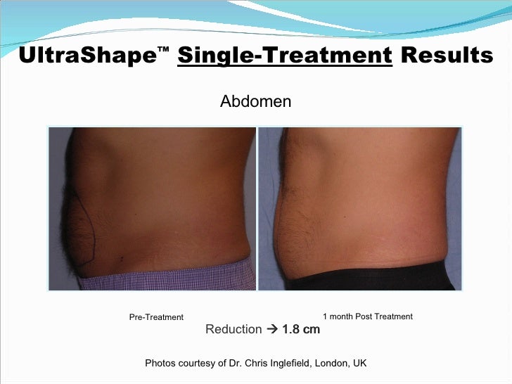 Flank Area (small): Position the