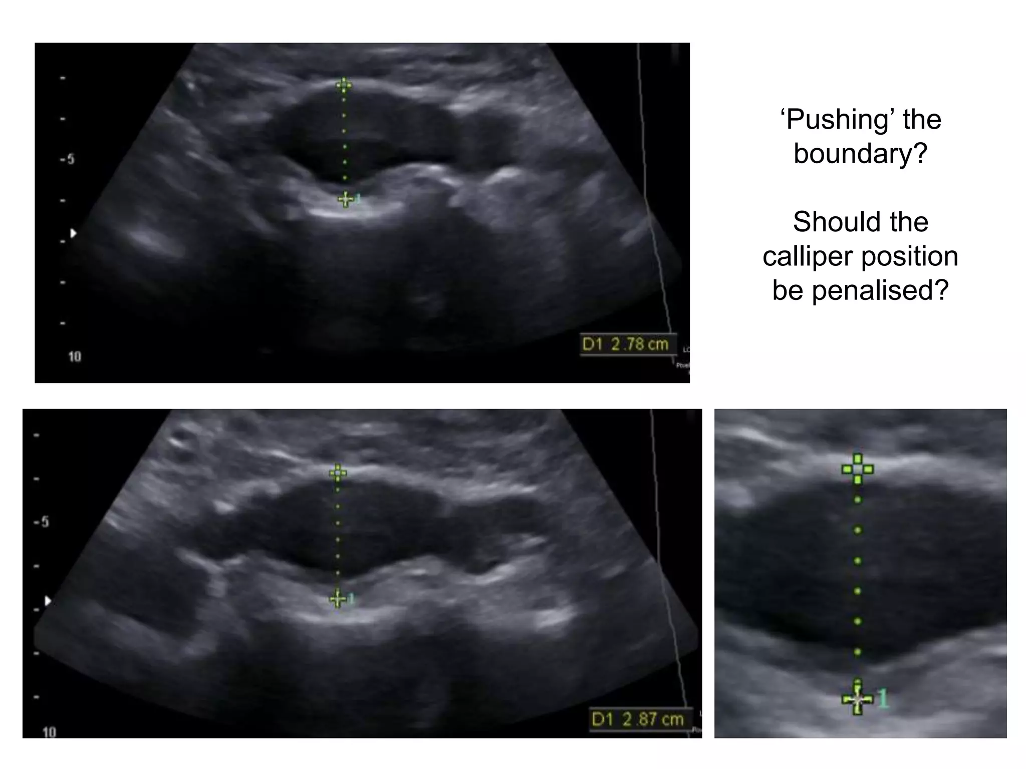 Ultrasound image presentation Tim Hartshorne | PPTX
