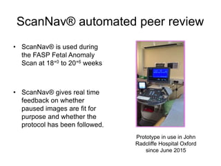 Ultrasound image presentation Tim Hartshorne | PPTX