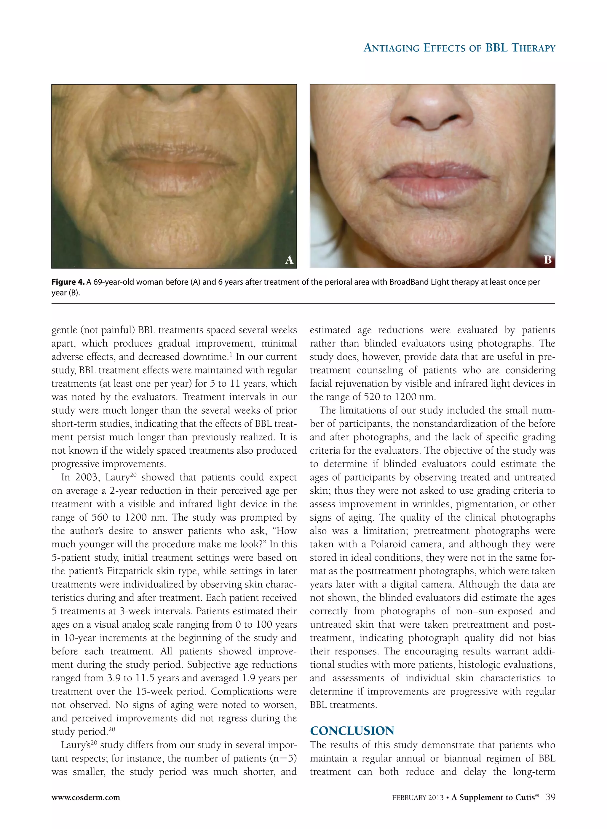 Long term-evaluation-of-the-anti aging-effects-of-broadbandlight ...