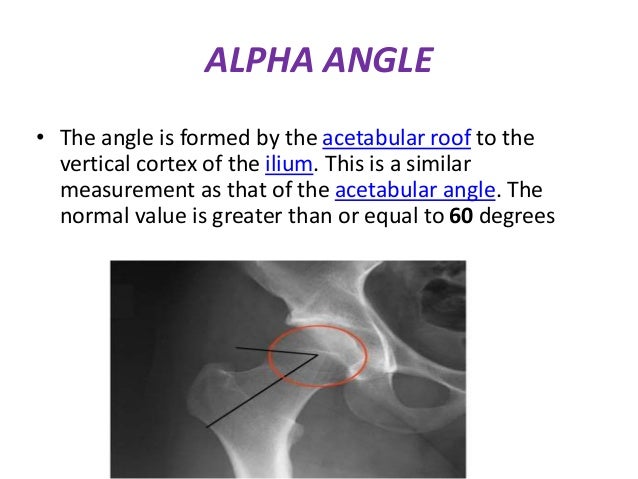 Ortho Journal Club 4 by Dr Saumya Agarwal