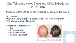 Long Term Treatment for Severe Alopecia Areata with Oral Tofacitinib ...