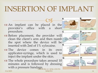 LONG ACTING REVERSIBLE CONTRACEPTIVES (LARC).pptx