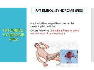 Long bone fracture complication | PPTX