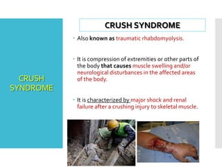 Long bone fracture complication | PPTX