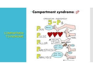 Long bone fracture complication | PPTX